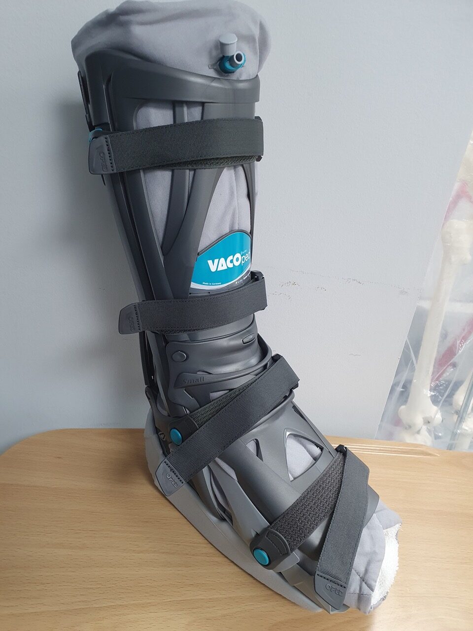 Below knee cast – Plaster Room